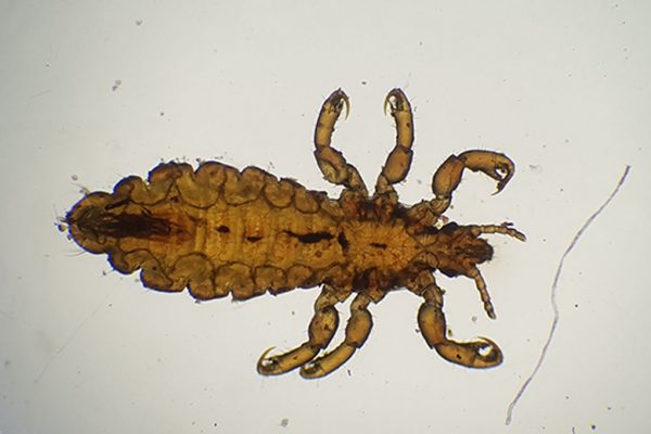 How To Identify, Treat, and Prevent Chicken Lice